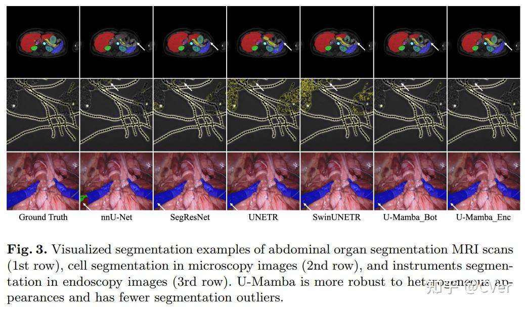 革新医学图像分割！刷新多个SOTA！U-Mamba：生物医学图像分割新网络 - 知乎