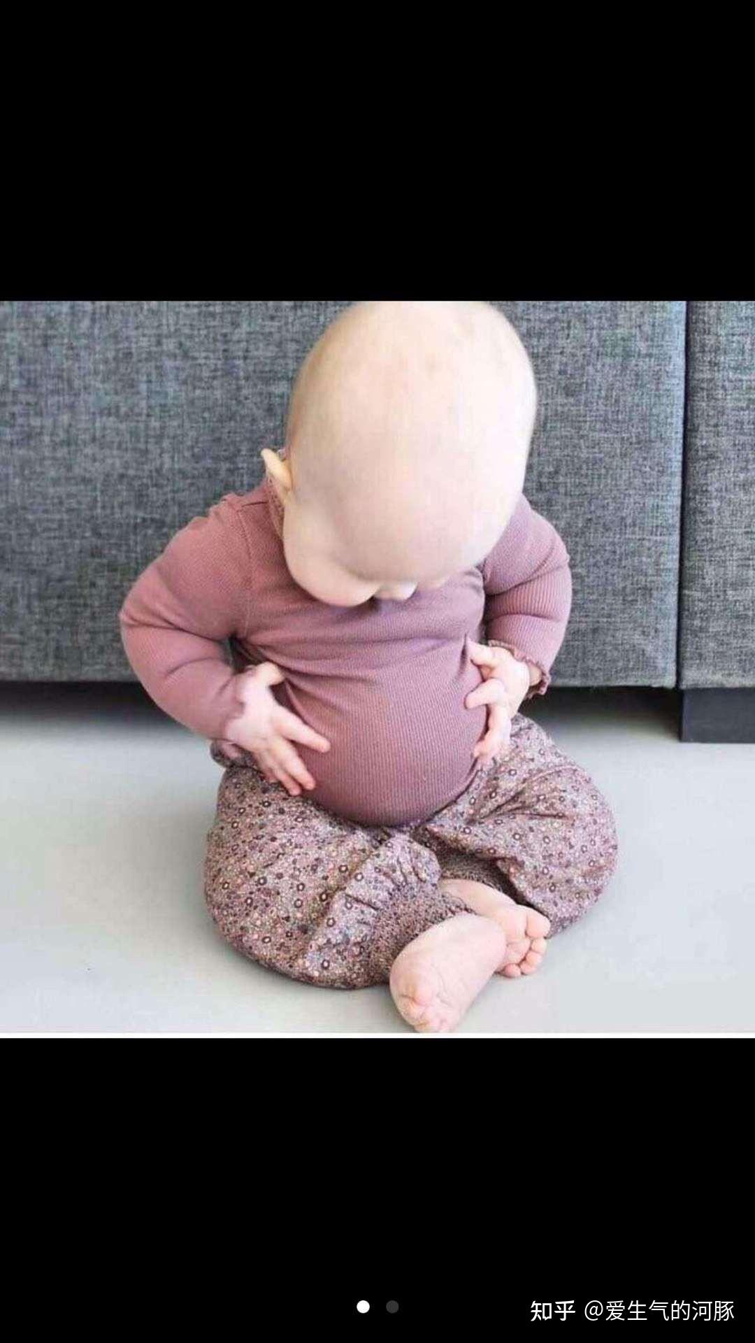 孕早期胎儿NT检查 - 知乎