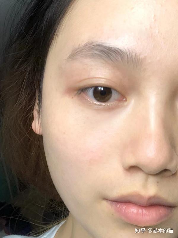 我鼻子长满了黑头,像芝麻粒一样,挤出来还带黑色的根儿,超级恶心,求推荐真正好用的去黑头产品 知乎