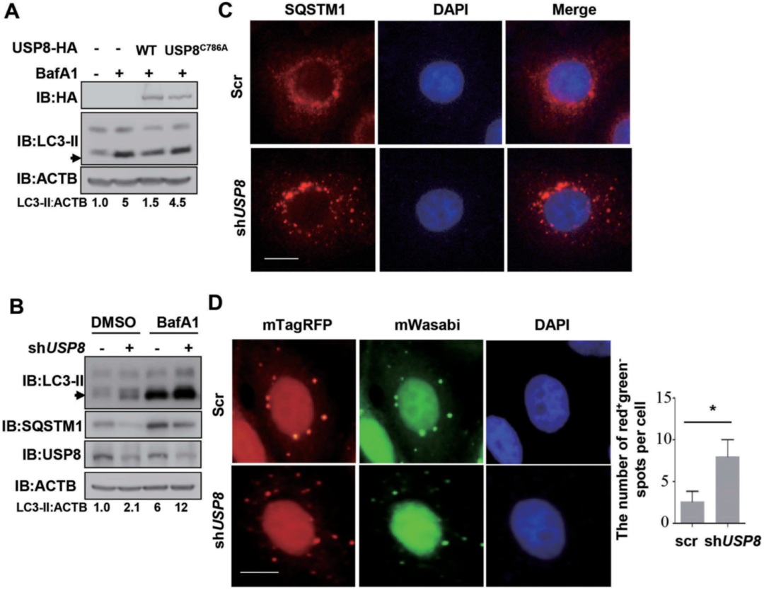 泛素特异性蛋白酶USP8直接对SQSTM1/p62进行去泛素化，以抑制其自噬活性 - 知乎