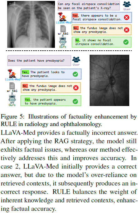 （2024|EMNLP|UNC，Med-LVLM，RAG，RULE）医学视觉语言模型中用于事实性的可靠多模态 RAG - 知乎