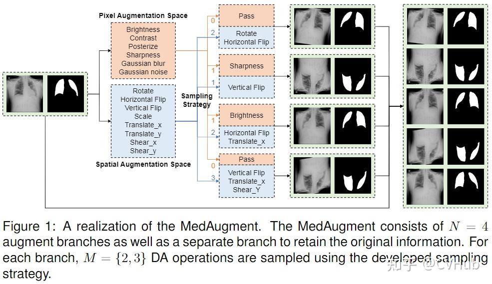 即插即用系列！| MedAugment: 用于图像分类和分割的自动数据增强插件（附Pytorch源码） - 知乎