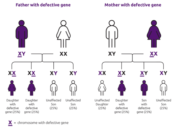 单基因遗传病之法布里病（Fabry’s Disease） - 知乎