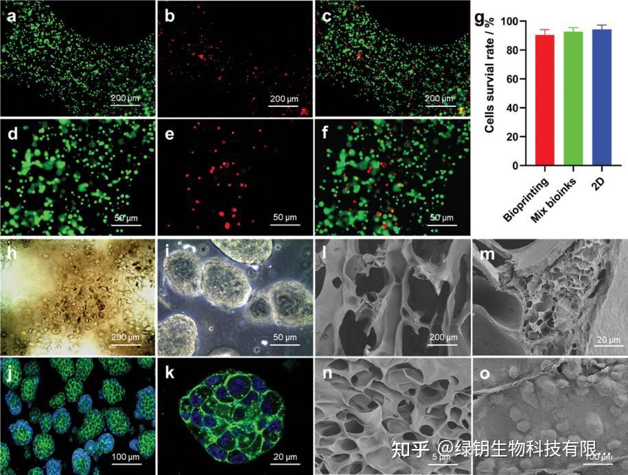 安徽医科大学《AHM》 | 通过ITGA2/p-AKT信号通路检测3D生物打印神经胶质瘤耐药性 - 知乎