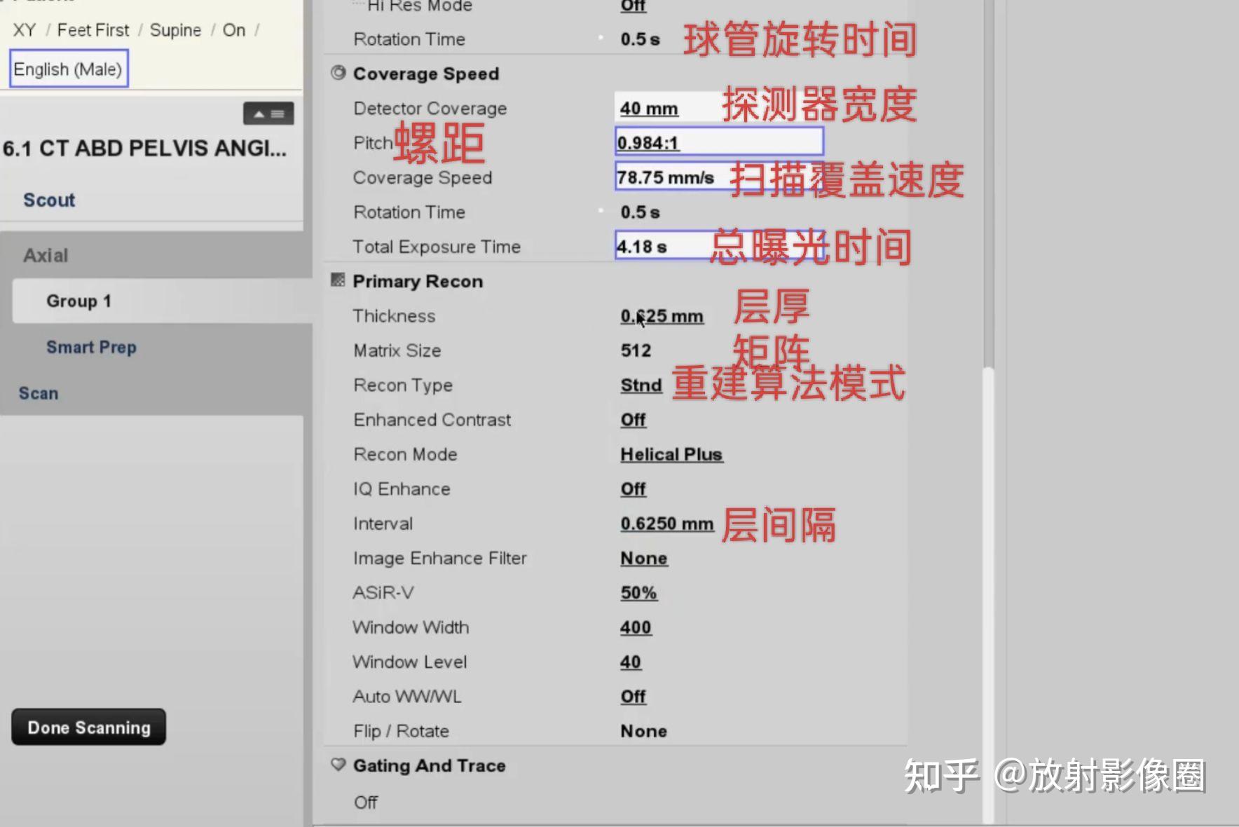 GE Revolution CT操作指南及问题汇总(一) - 知乎
