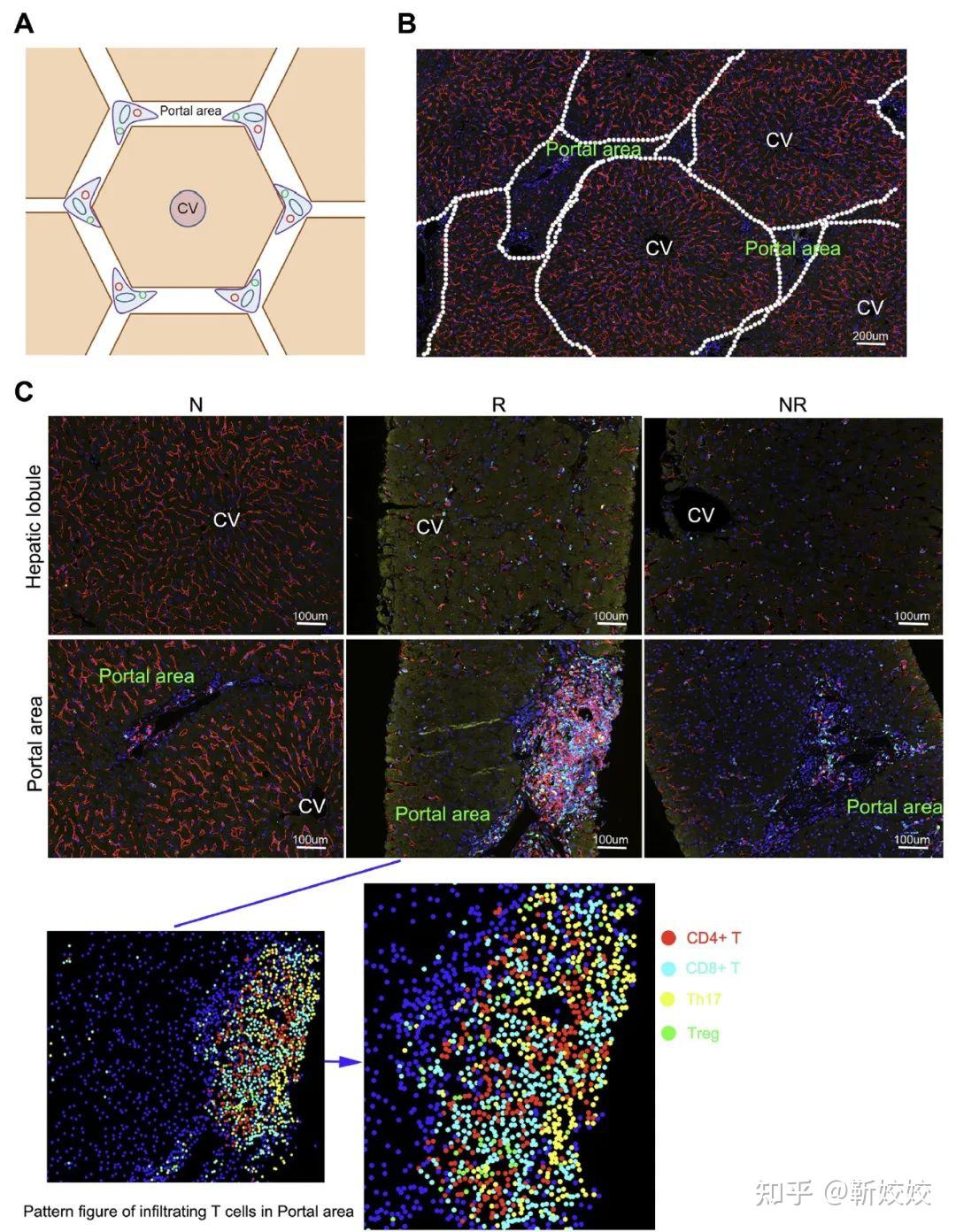 肝移植组织微环境研究，多重荧光免疫组化有这些新发现！ - 知乎