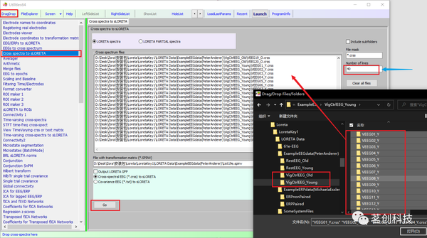 基于LORETA的EEG静息态脑网络分析 - 知乎