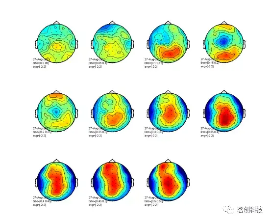 超详细TMS-EEG数据处理教程（下） - 知乎