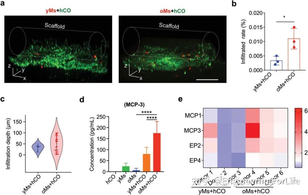 《Advanced Science》：哈佛大学Luke P.Lee类器官研究再下一城，成功监测免疫驱动大脑衰老过程 - 知乎