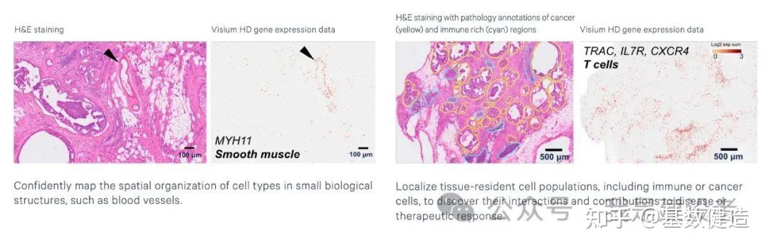 10x Genomics终于推出新的 Visium HD 平台！ - 知乎