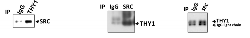 干货知识：蛋白实验之——CO-IP实验怎么做？这些注意事项你值得拥有！ - 知乎