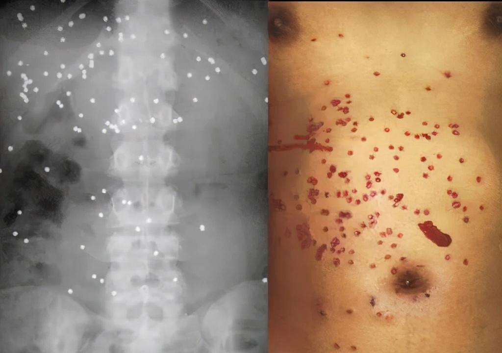 霰弹枪：游戏里唯唯诺诺，现实中重拳出击 - 知乎