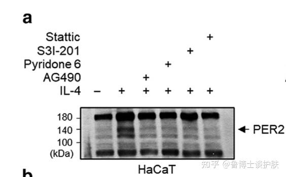 炎症因子IL-4通过EGR1调控节律系统中枢基因PER2 - 知乎
