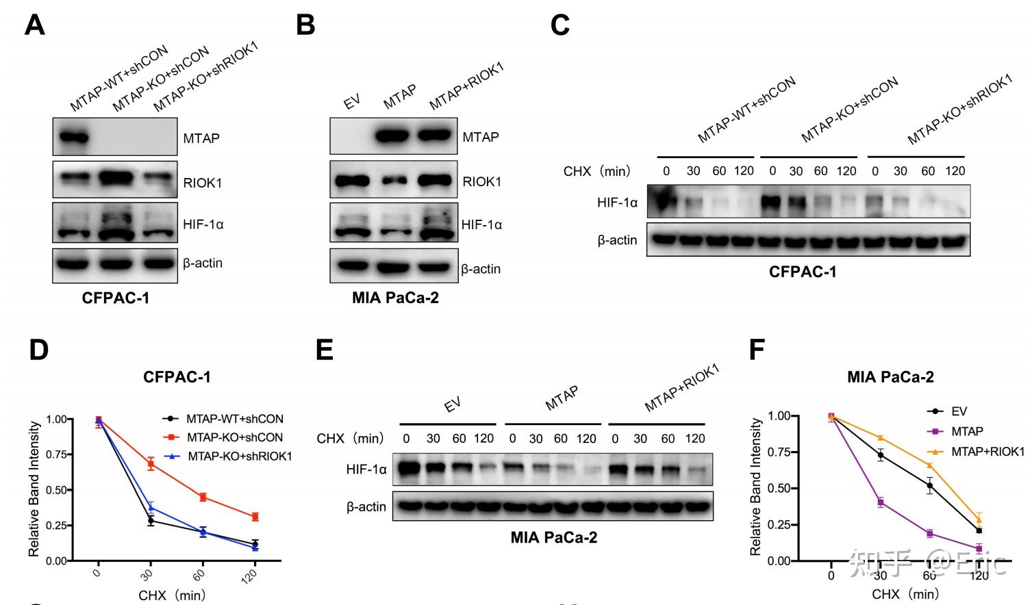 Cancer research | MTAP缺失诱导的代谢重塑增加胰腺癌嘌呤从头合成和糖酵解共靶向敏感性 - 知乎