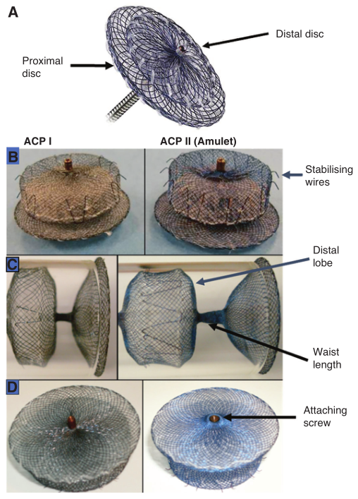 左心耳封堵器械介绍及临床研究解读 - 知乎