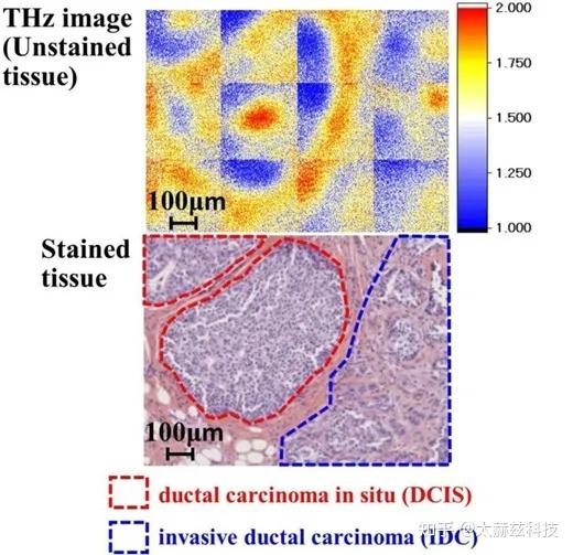THz | 太赫兹技术-癌症诊断的新视角 - 知乎