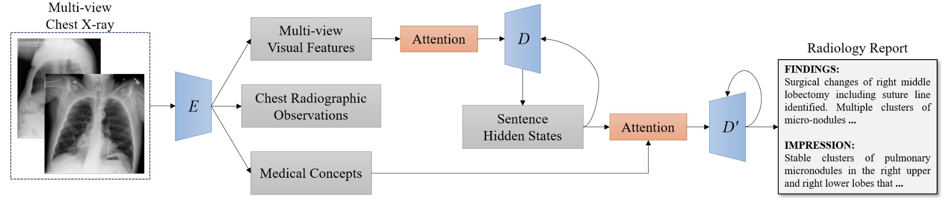 [论文笔记]Automatic Radiology Report Generation - 知乎