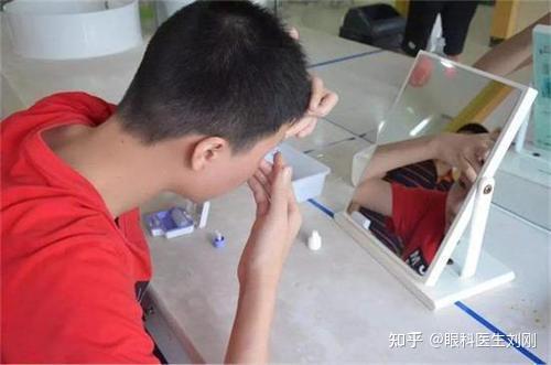 OK镜的使用和疗效 - 知乎