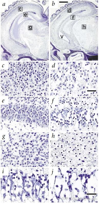 一文带你了解Creb1基因——研究神经系统及肌肉再生的关键基因 - 知乎