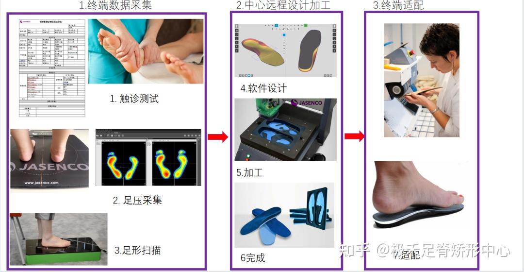 普通鞋垫和定制矫形鞋垫的区别是什么？ - 知乎