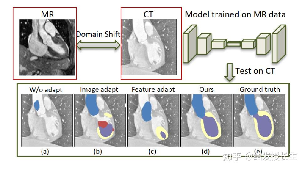 【Domain Adaptation】协同图像与特征自适应: 面向医学图像分割的跨模态域自适应 - 知乎
