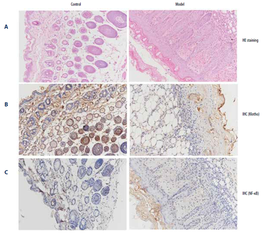 Klotho蛋白在皮肤光防护中的作用 - 知乎