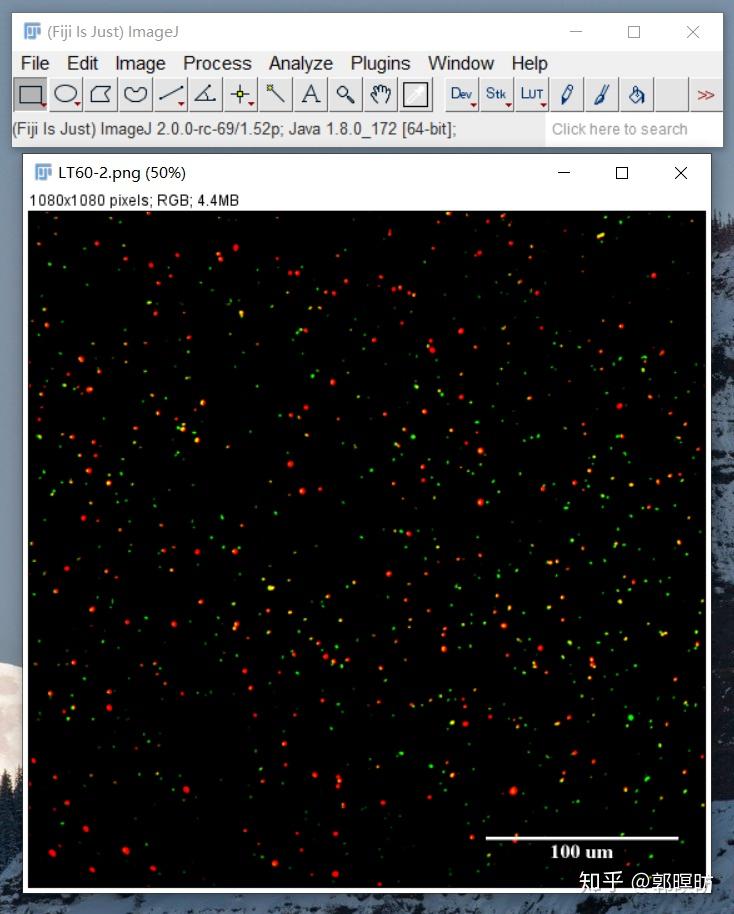 ImageJ使用心得之Particle Analysis （一） - 知乎