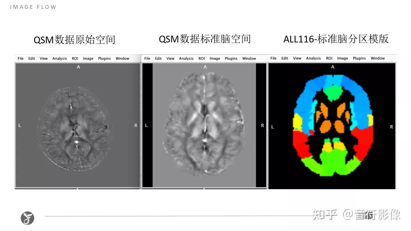 定量磁敏感成像（QSM）数据处理教程 - 知乎