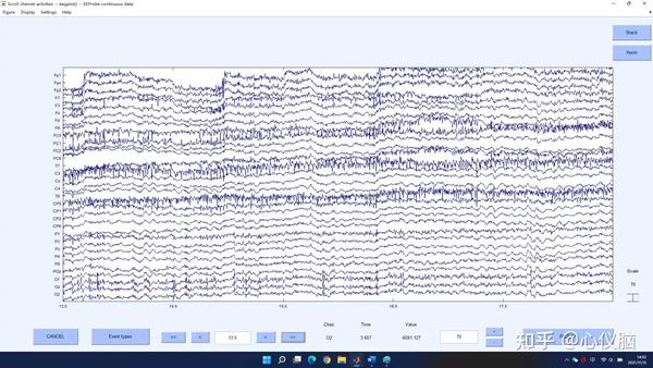 无需代码！图文并茂详解EEGLAB中的ERPs数据分析方法 - 知乎