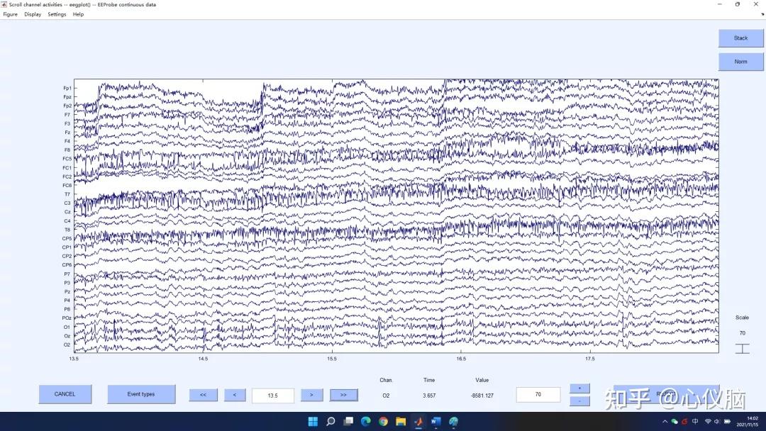 无需代码！图文并茂详解EEGLAB中的ERPs数据分析方法 - 知乎