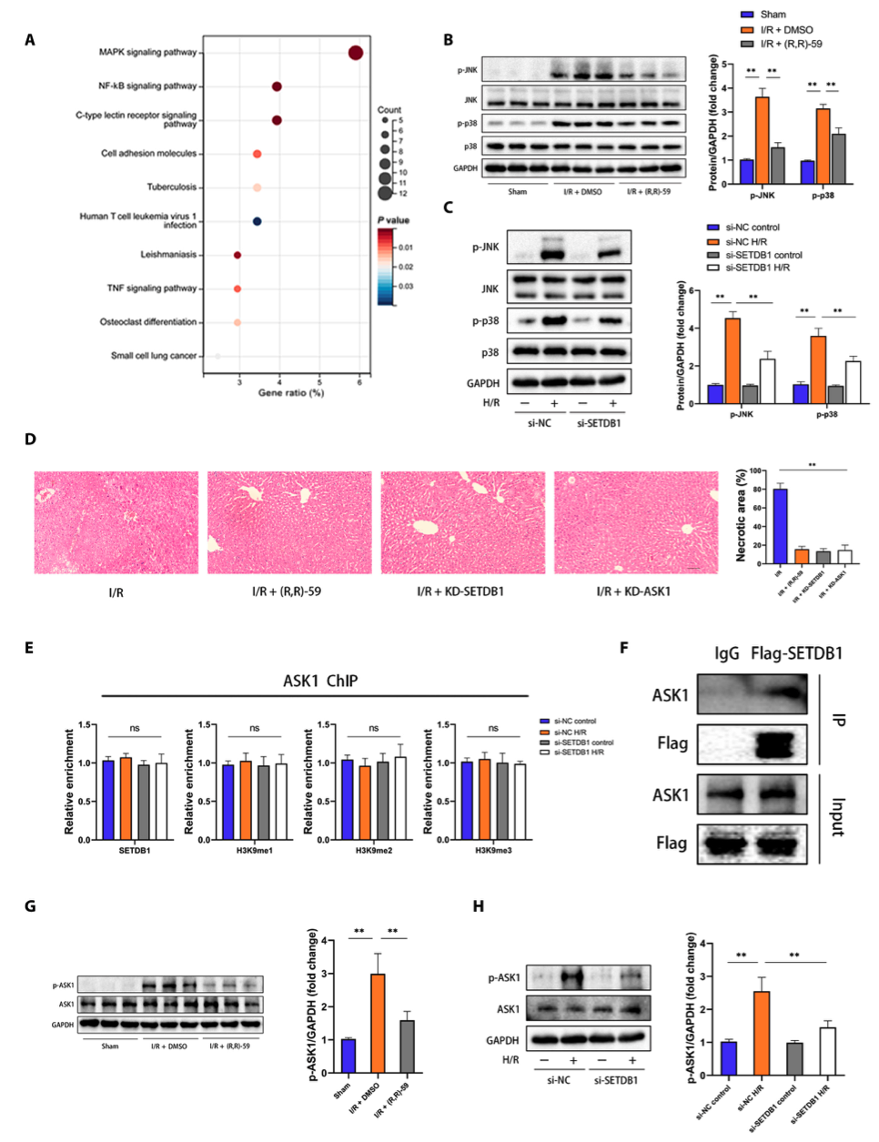国产顶刊Research丨肝细胞 SETDB1 通过靶向 ASK1 信号的赖氨酸甲基化调控肝缺血再灌注损伤 - 知乎