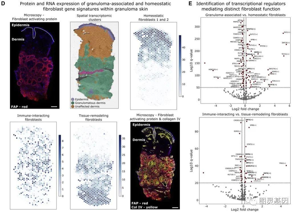 Cell Discov ｜ CD36+癌细胞抑制巨噬细胞迁移为肝癌提供免疫抑制微环境 - 知乎