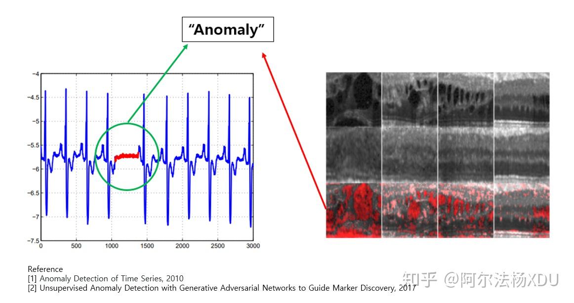 异常检测 | Anomaly Detection综述 - 知乎