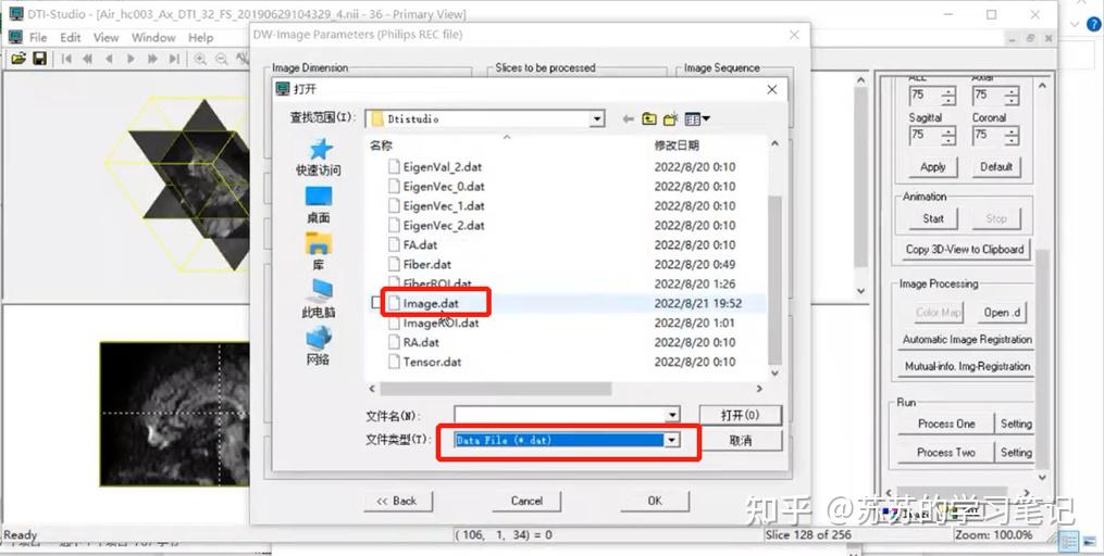 DTI Studio操作教程 - 知乎