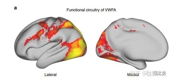 Nature communications：VWFA，一个集语言与注意于一身的脑区 - 知乎