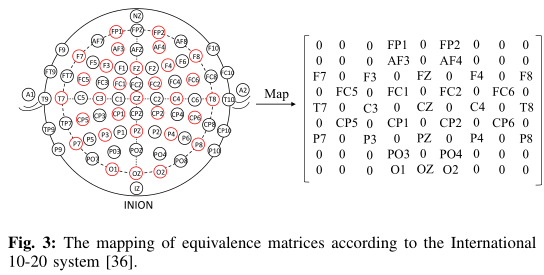Emotion Recognition from Multi-Channel EEG via Deep Forest 论文阅读 - 知乎