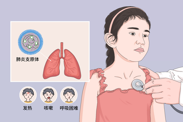 肺炎支原体:多西环素是阿奇霉素耐药最佳选择 知乎