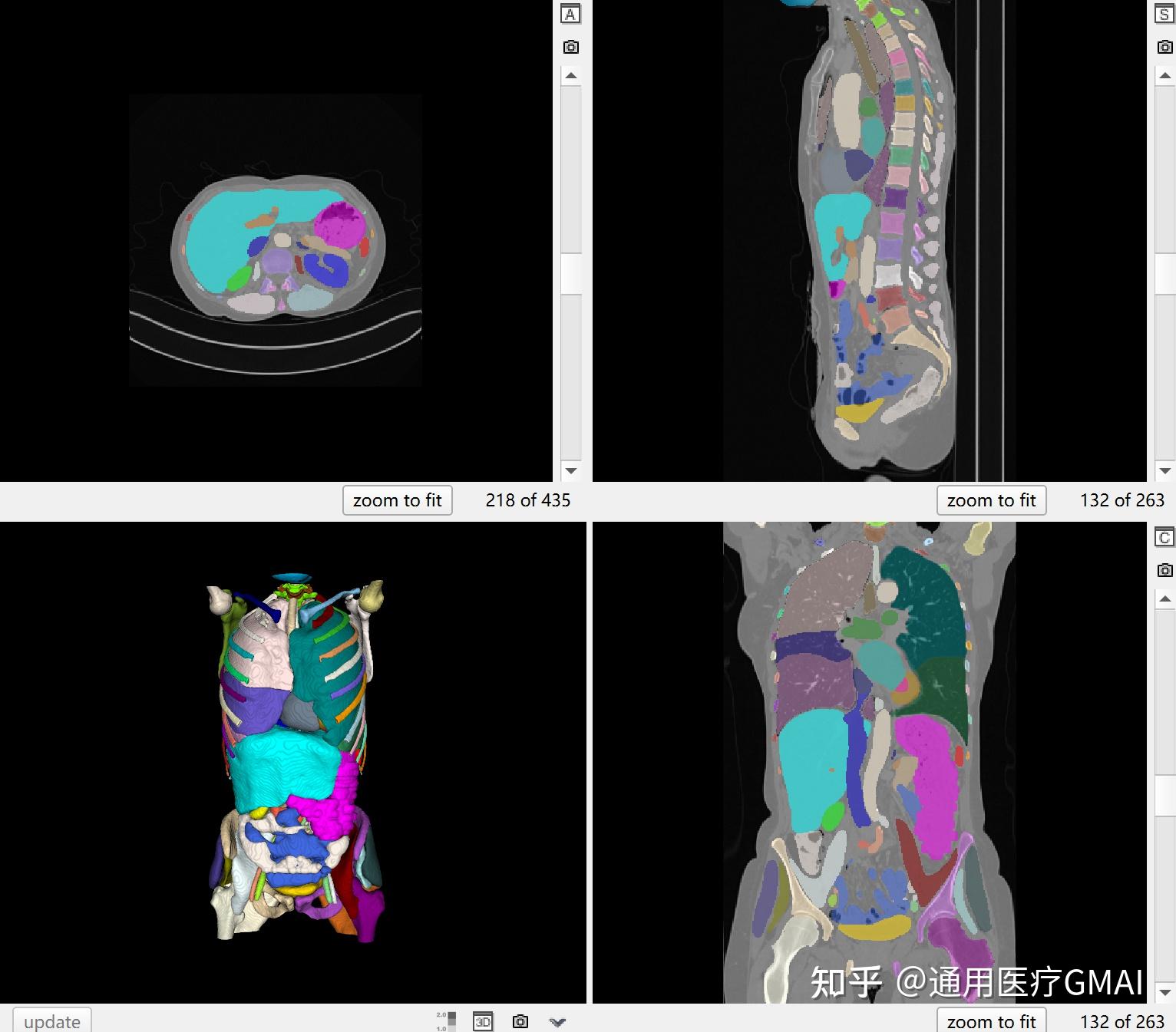 TotalSegmentator 数据集介绍 - 知乎