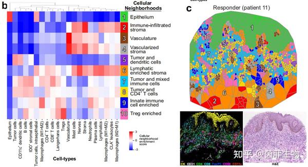 Nat Commun | CODEX——SpatialScore预测皮肤T细胞淋巴瘤对PD-1阻断响应的空间生物标志物 - 知乎
