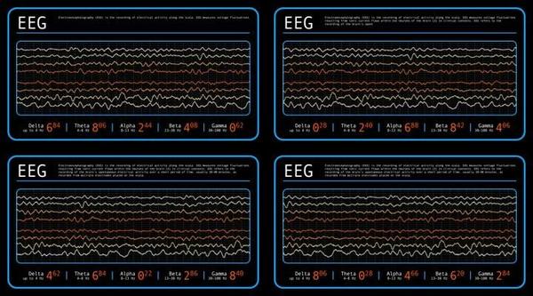手把手教你脑电波采集及信号处理分析 - 知乎