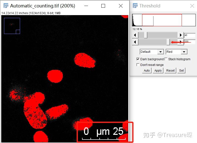 ImageJ实用技巧——自动细胞计数(解放双手篇) - 知乎
