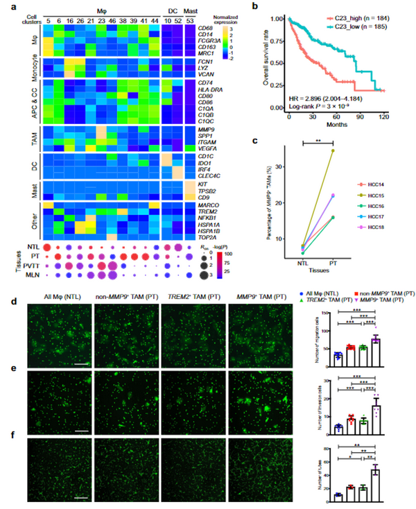 项目文章丨单细胞测序揭示原发及转移性肝癌的免疫微环境特征 - 知乎