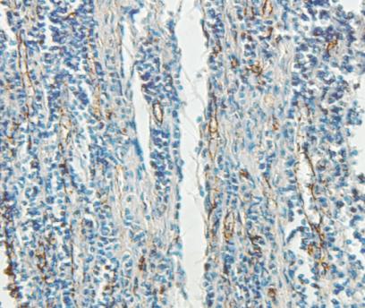 噬菌体展示技术关键及优势 - 知乎