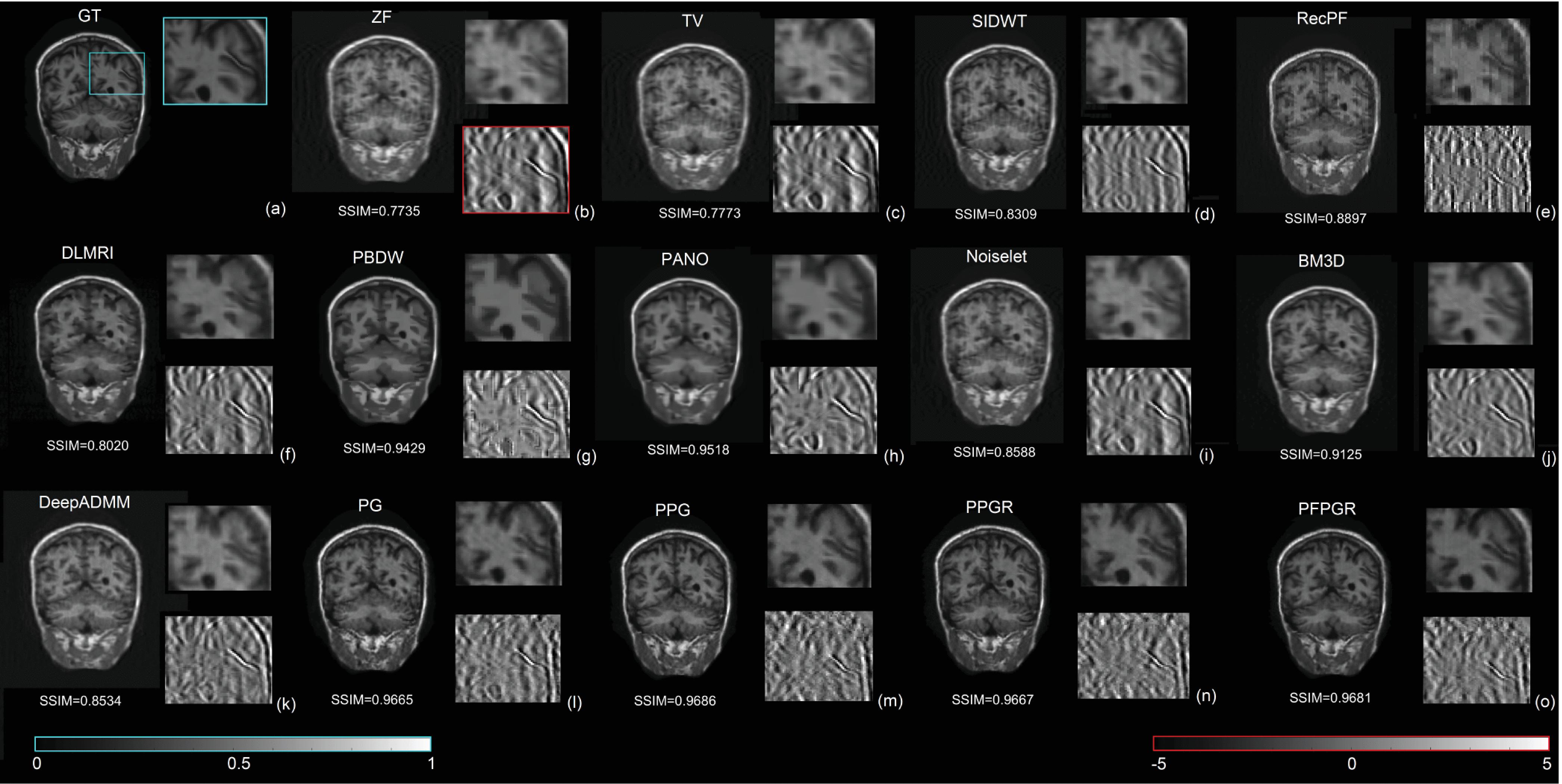 DAGAN: DAGAN for Fast CS-MRI Reconstruction - 知乎