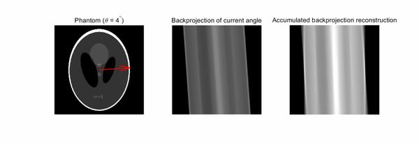 MATLAB医学成像模拟——CT重建算法（滤波反投影） - 知乎