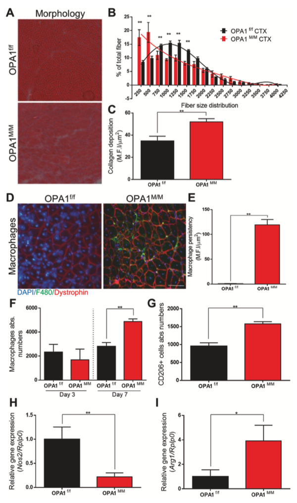 CDD丨OPA1 通过 p65 信号驱动巨噬细胞代谢和功能承诺 - 知乎