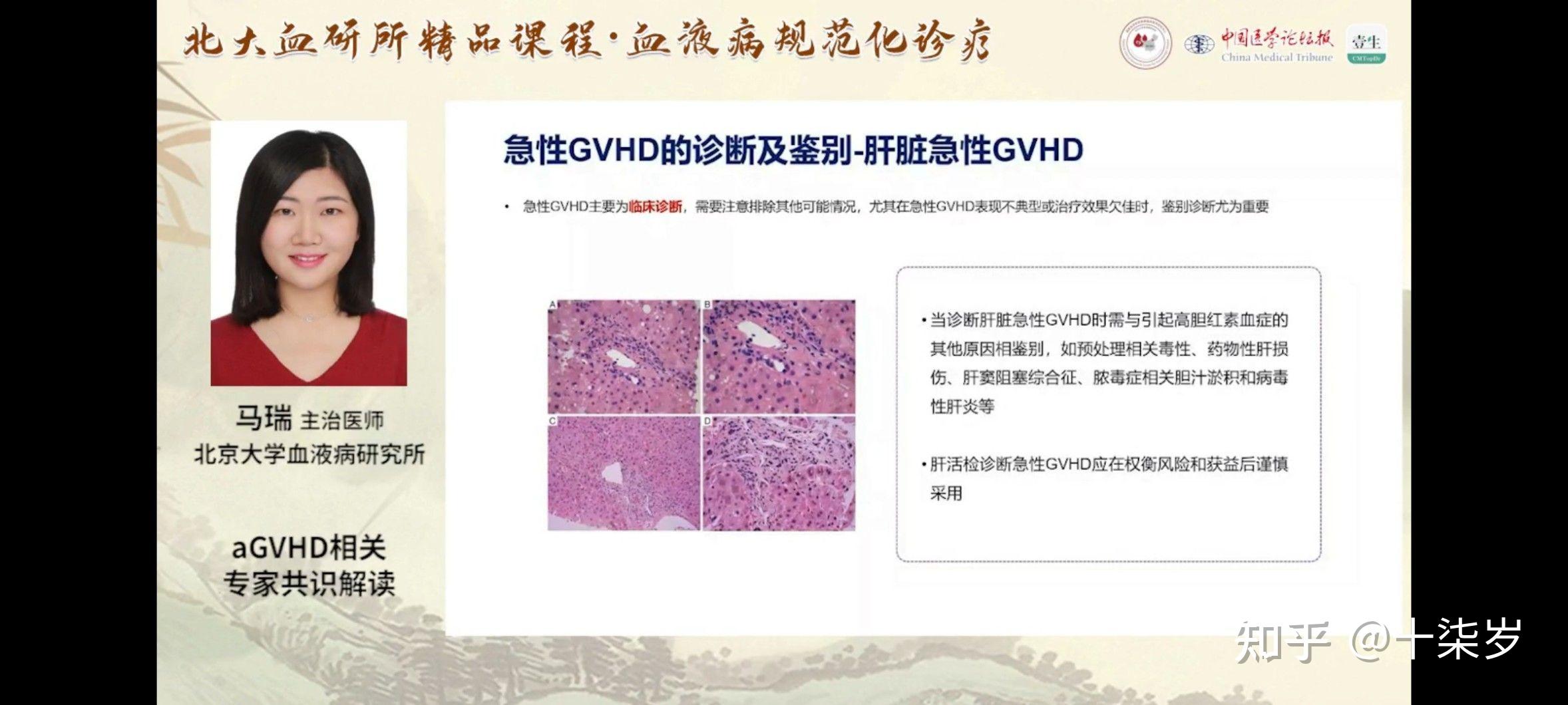 GVHD表现和评分 - 知乎