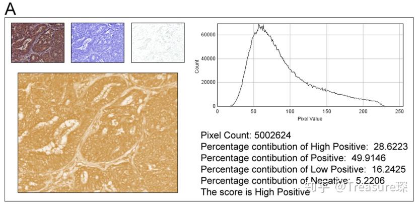 ImageJ实用技巧——免疫组化分析(定量分析篇) - 知乎