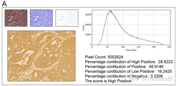 ImageJ实用技巧——免疫组化分析(定量分析篇) - 知乎