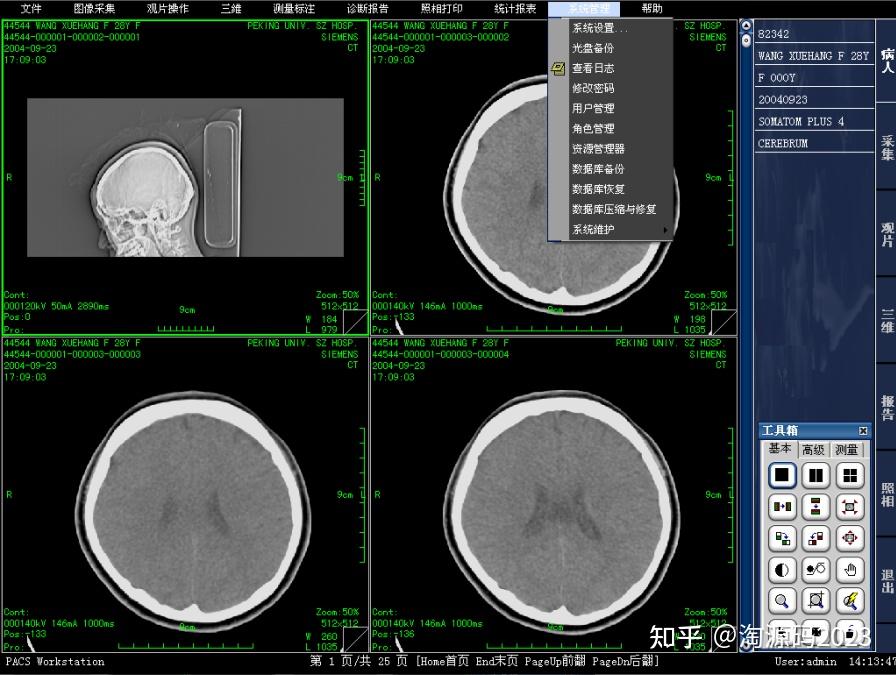 什么是医学影像PACS系统？PACS系统功能有哪些？作用有哪些？对接哪些设备？业务流程是什么？ - 知乎